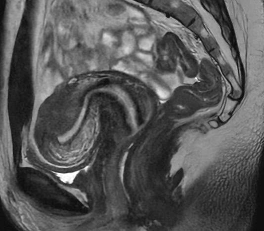IRM pelvis féminin | Diamorphos, imagerie médicale à Brest