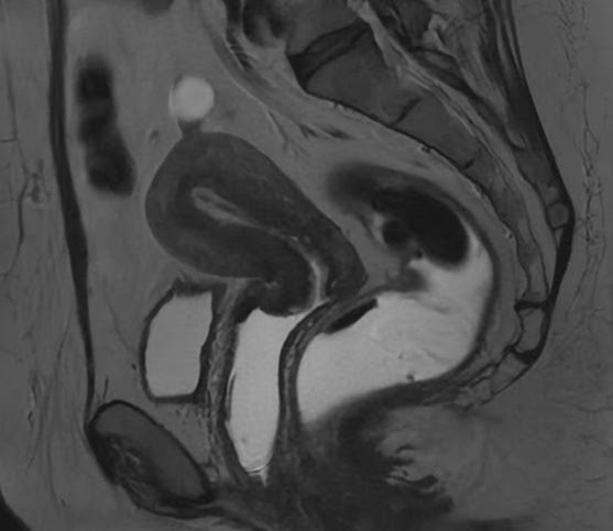 IRM pelvienne dynamique | Diamorphos, imagerie médicale Brest