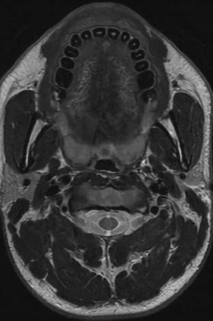IRM ORL | Diamorphos, imagerie médicale à Brest
